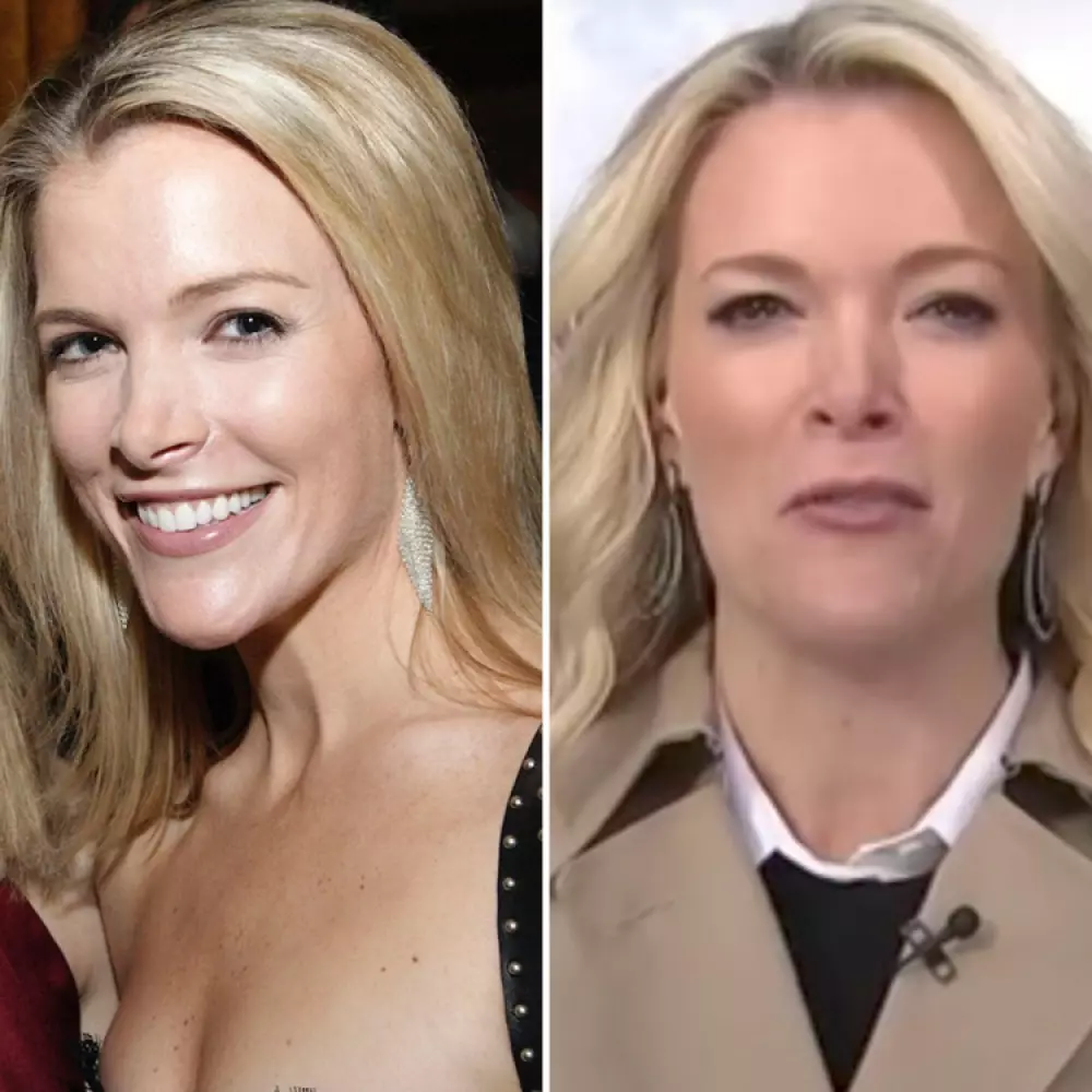 megyn kelly fandidiana plastika getty images