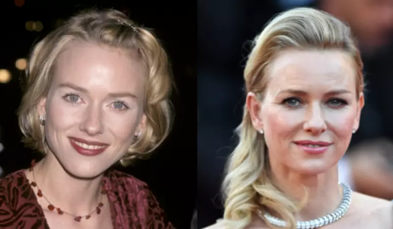 naomi-watts-ingen-plastisk-kirurgi