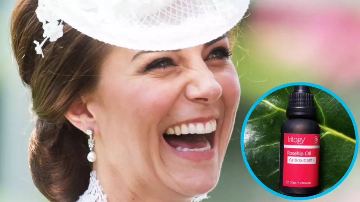 Kate Middleton sejas eļļa getty images instagram