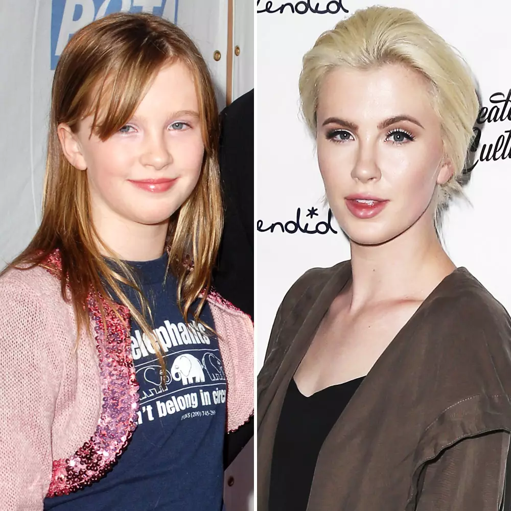 Ireland - Baldwin