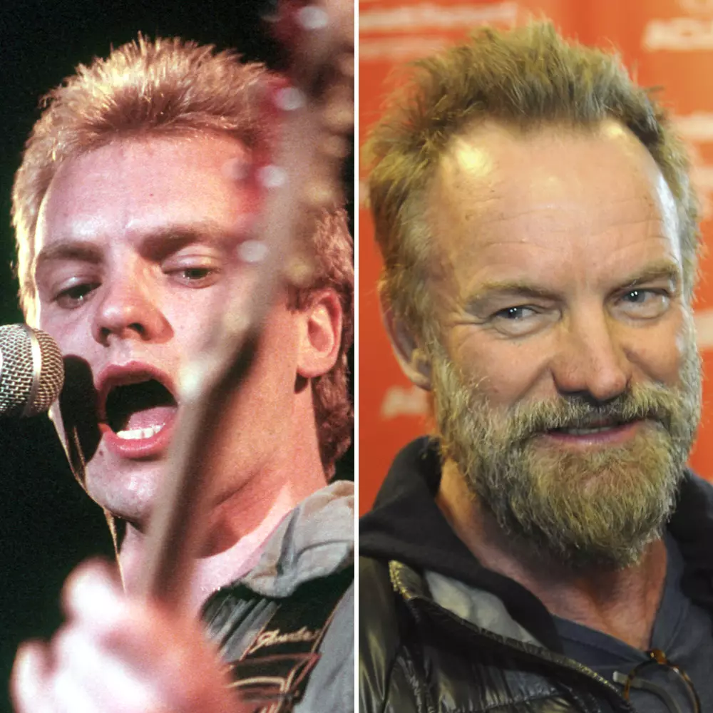 sting