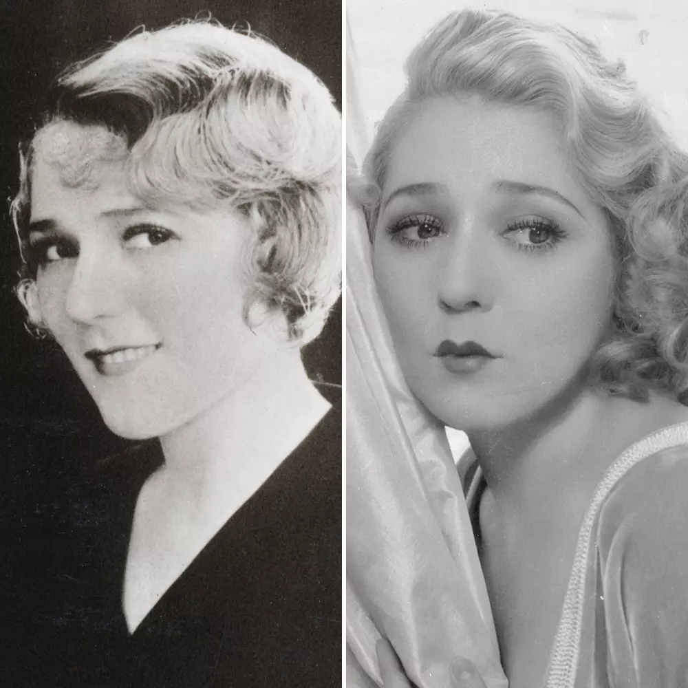 mary-pickford-kirurgia