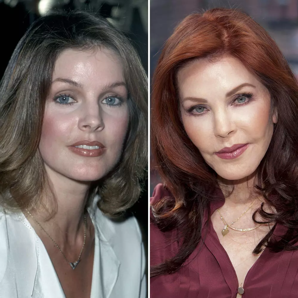 priscilla-presley-chirurgie