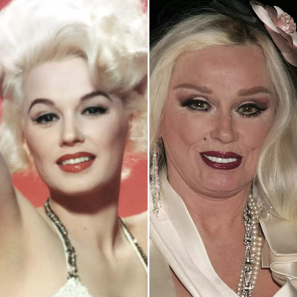 mamie-van-doren-cirurgia