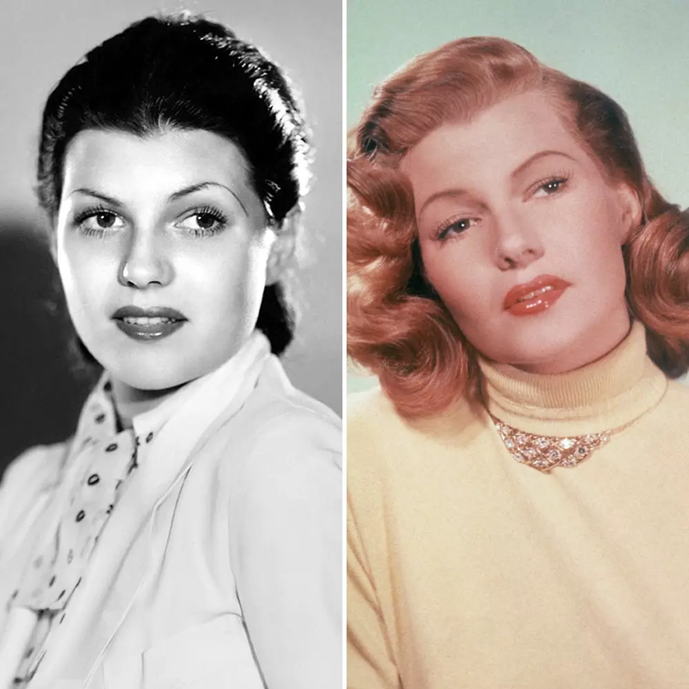 rita-hayworth- ការវះកាត់