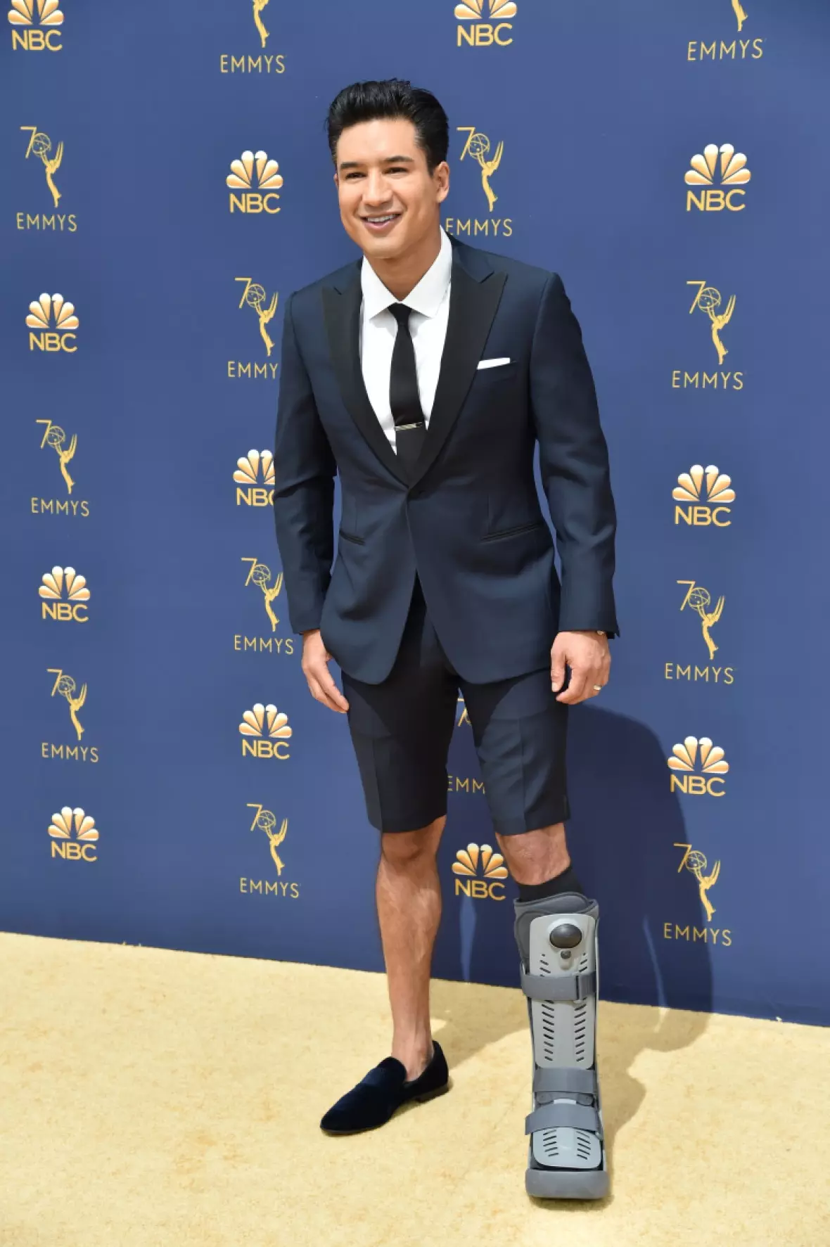 mario lopez meiddur á fæti