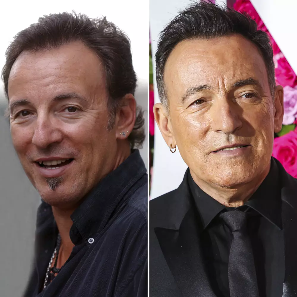 bruce springsteen kirurġija plastika getty immaġini